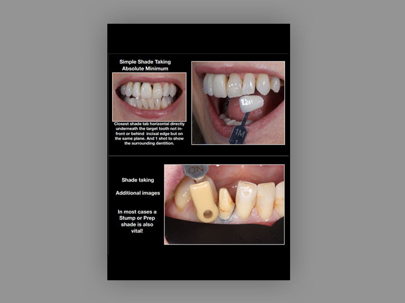 News - Beever Dental